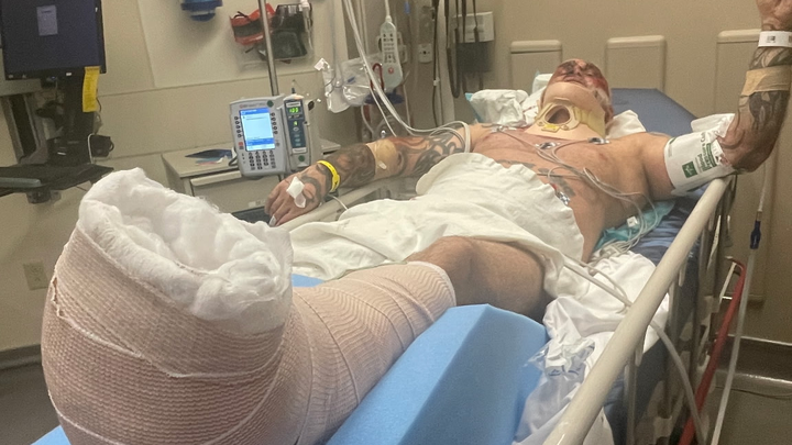 Fundraiser by Tracey Oder : Stand by Jeremy After His Accident