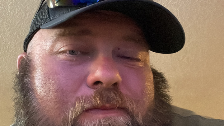 Fundraiser by David Marsh : David's Path to Hand Recovery