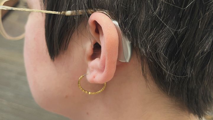 Fundraiser by Carl Merrill : Get Carl New Ears!