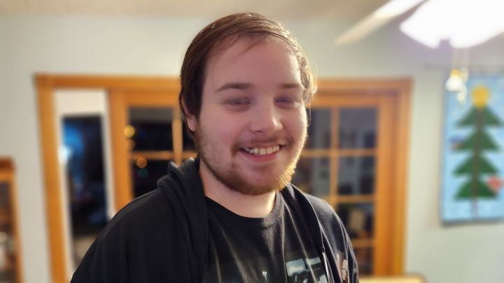 Fundraiser by Marilyn Prince : Help my wonderful boy get his smile back