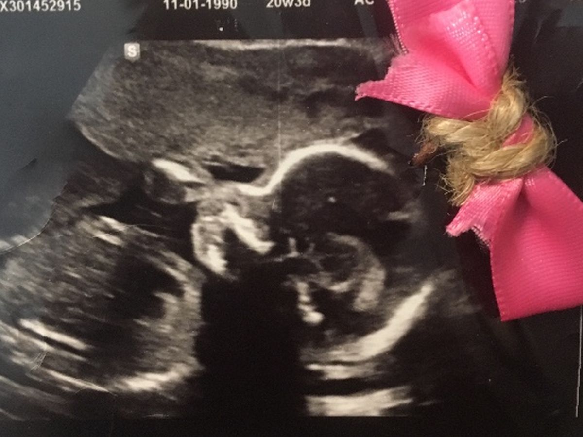 Fundraiser for Katelyn Furley by Laura Rickert : Jessileeia memorial fund