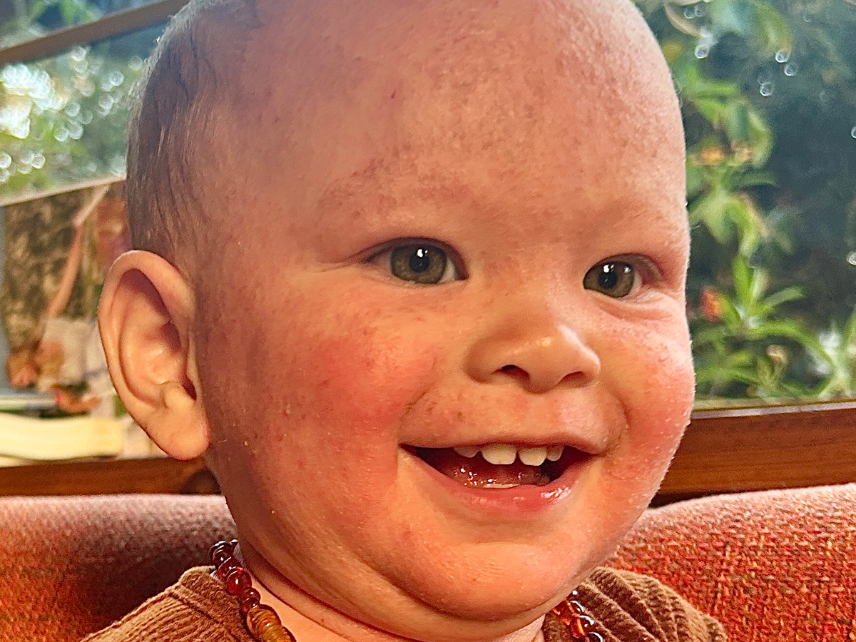 Fundraiser by Zoe Atlas : Support Baby Jacob Healing Severe Eczema