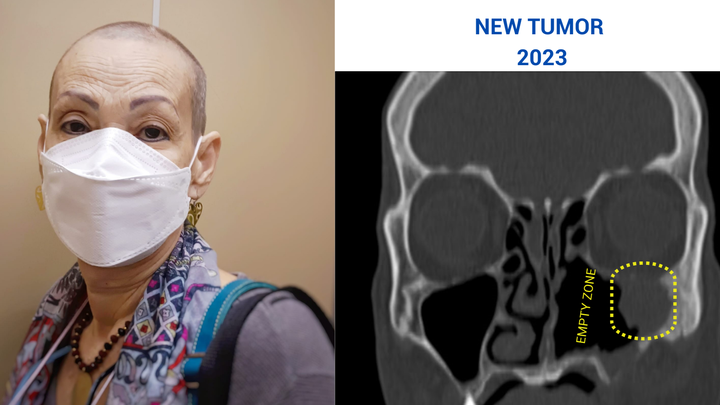 Fundraiser for Marelis Cardenas by Anavict Romero : Por favor ayuda a ...