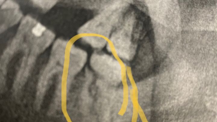 Fundraiser for Luke Oliver by Cody Cluff : Help Luke with his medical bills