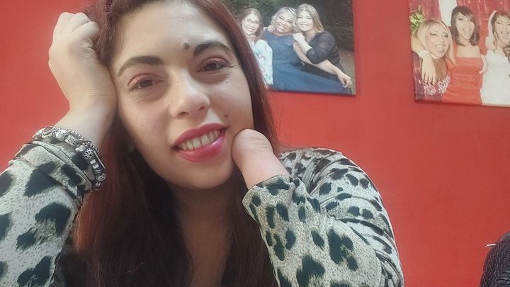 Fundraiser By Cristiana Innocenti Mi Date Una Mano” Protesi Bionica