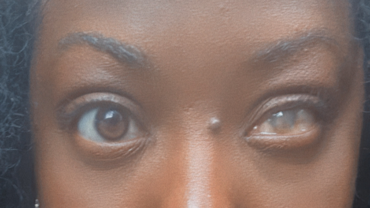 Fundraiser by Jarnae Carter : Assistance for Scleral Shell and Conformer