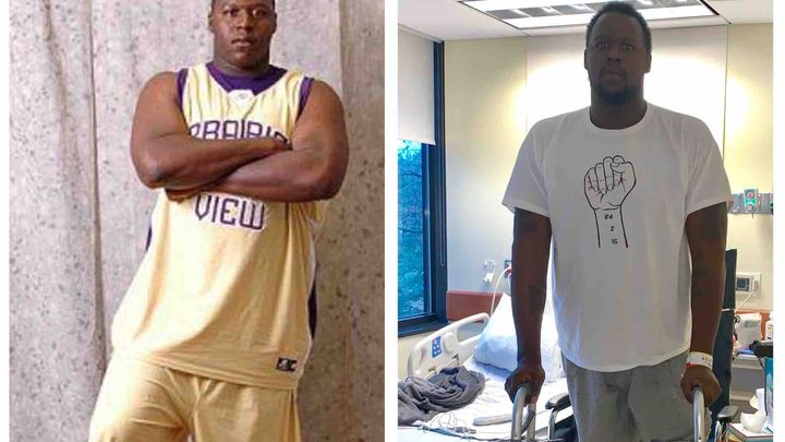Fundraiser by Terence Yung Levert Moore : Sarcoma Cancer Survivor/Amputee