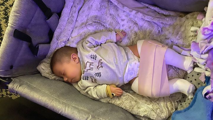 Fundraiser by Misty Links : Baby Massiah - Arthrogryposis Multiplex ...