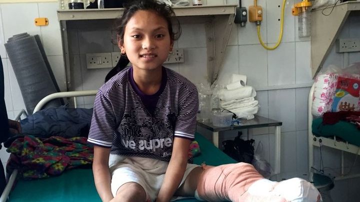 Fundraiser by Samarpan Gurung : Help Maya for a New Leg: Urgent Leg ...