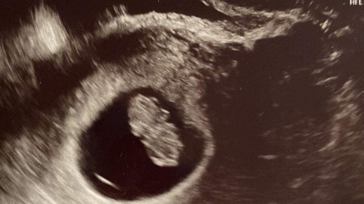 Fundraiser by Denise Delisle : Amber..Wyatte and Baby Dawson