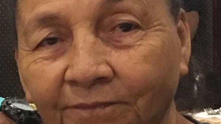 Fundraiser by Magda Colon : Ayuda para cirugía en las venas