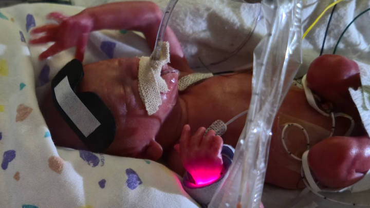 Fundraiser for Zebedee Mize by Tracy Mize : Azalea's burial and Zebedee ...