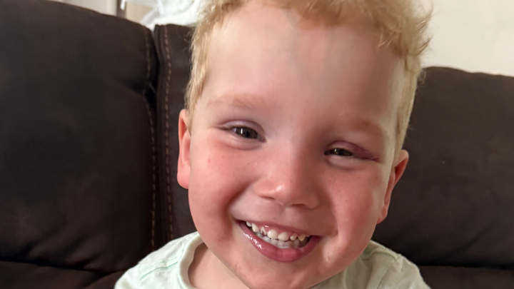 Fundraiser by JOe Martinez : Donate to help Archie in his recovery from ...