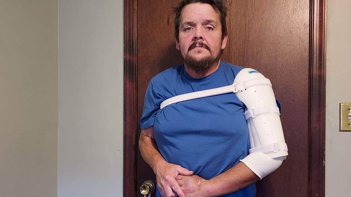 Fundraiser for Robin Silva by Patricia Link : Joe has a broken arm and ...