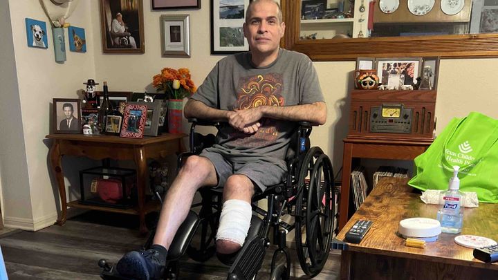 Fundraiser by CHRISTOPHER MARTINEZ : PROSTHETIC LEG AND MEDICAL BILLS ...