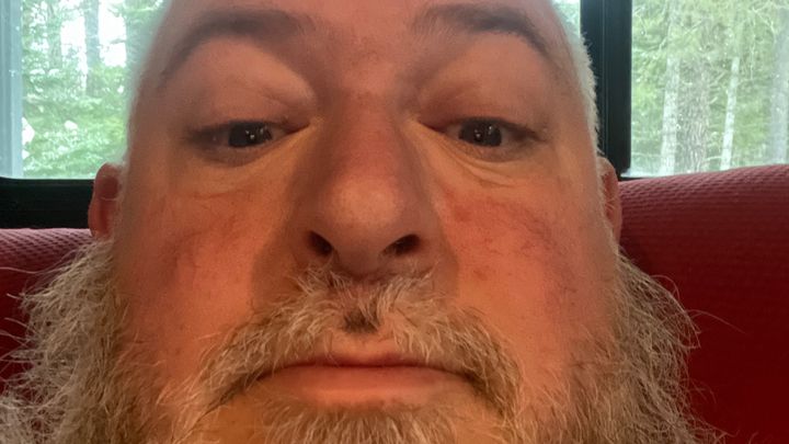 Fundraiser by Kenneth Roath : Pay for prosthetic leg