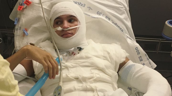 Fundraiser by Lance Vargas : Support a young athlete who lost his leg