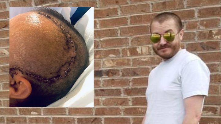 Fundraiser by Sarah Stokoe : Help Jake Smith Heal and Rebuild