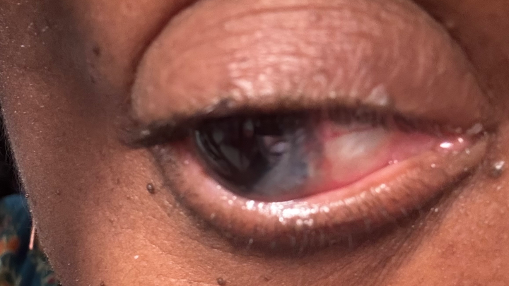 Fundraiser by Durga aka Pamela McBroom : Support Needed for Urgent ...