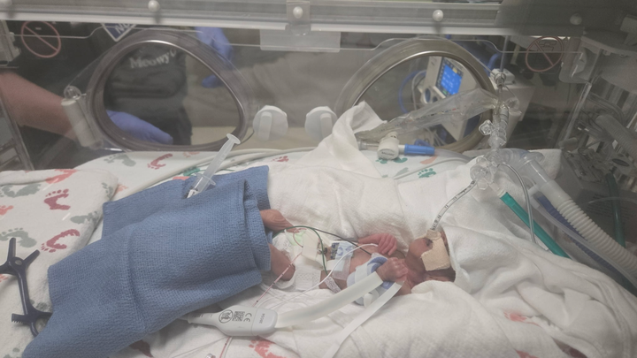 Fundraiser for Anu George by Casey Nelson : Support for Baby Smith and ...