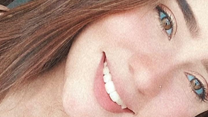 Fundraiser for Alice Agrusa by Maria Olave : Operación por luxación ...