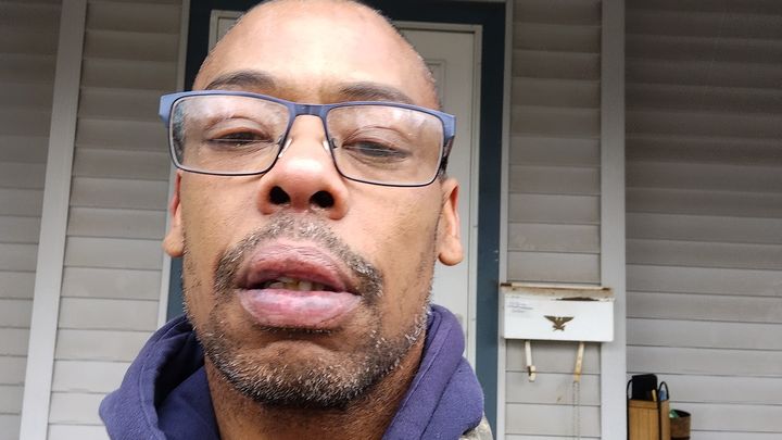 Fundraiser by Lawrence Gardner : Drug treatment program