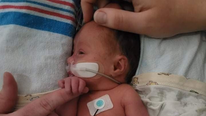 Fundraiser for Alex Dewald by Amanda Roggow : Let's Help Eleanor Grow ...