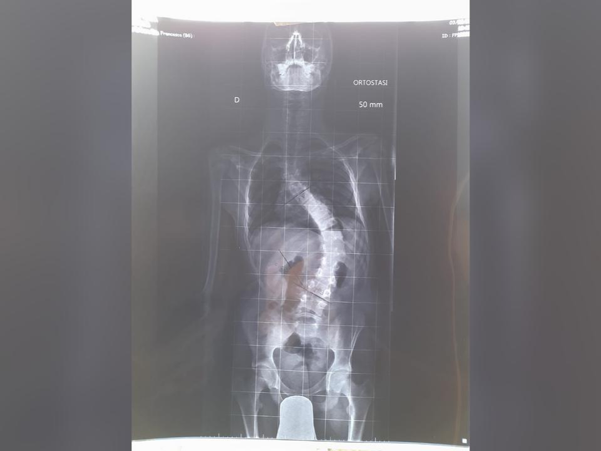 Fundraiser by Deutsche Kapuzinerprovinz Ambulance PROJECT Fushe Arrez ...