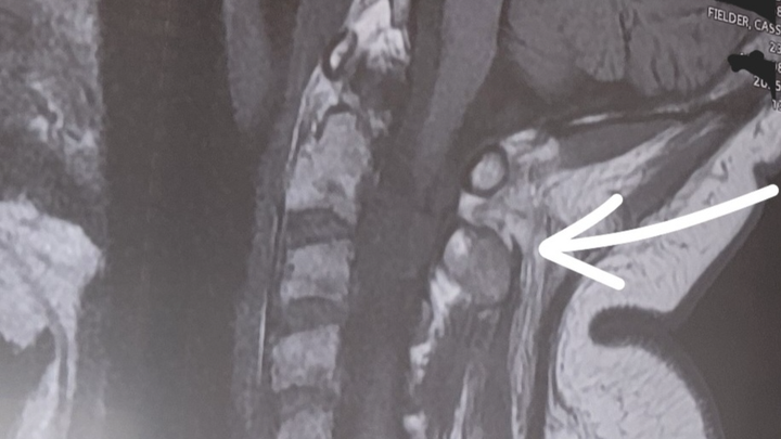 Fundraiser by Cassandra Fielder : Support Our Family's Tumor Battle Journey