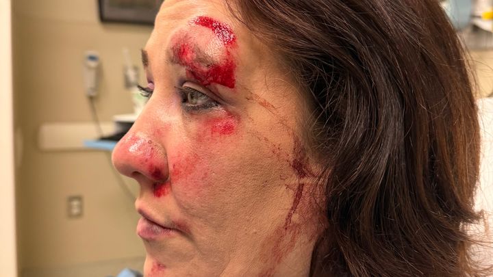 Fundraiser for Chantel Brown by Brittany Walsh : Help Chantel Heal ...