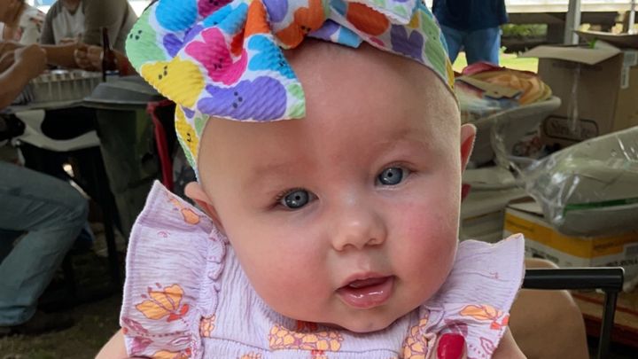 Fundraiser by Amanda Butler : Kennedi’s Docband helmet