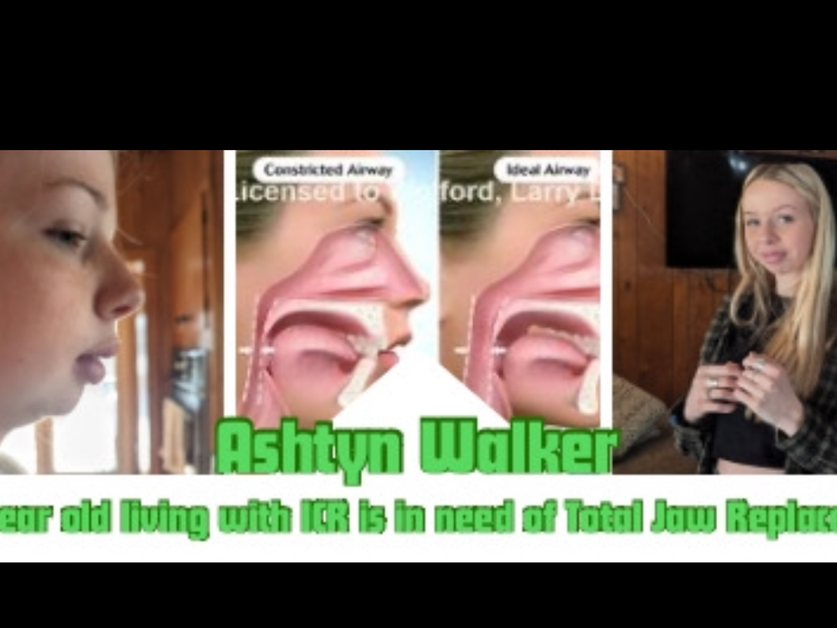 Fundraiser by Kylee Hanna : Help Ashtyn Prepare For Surgery