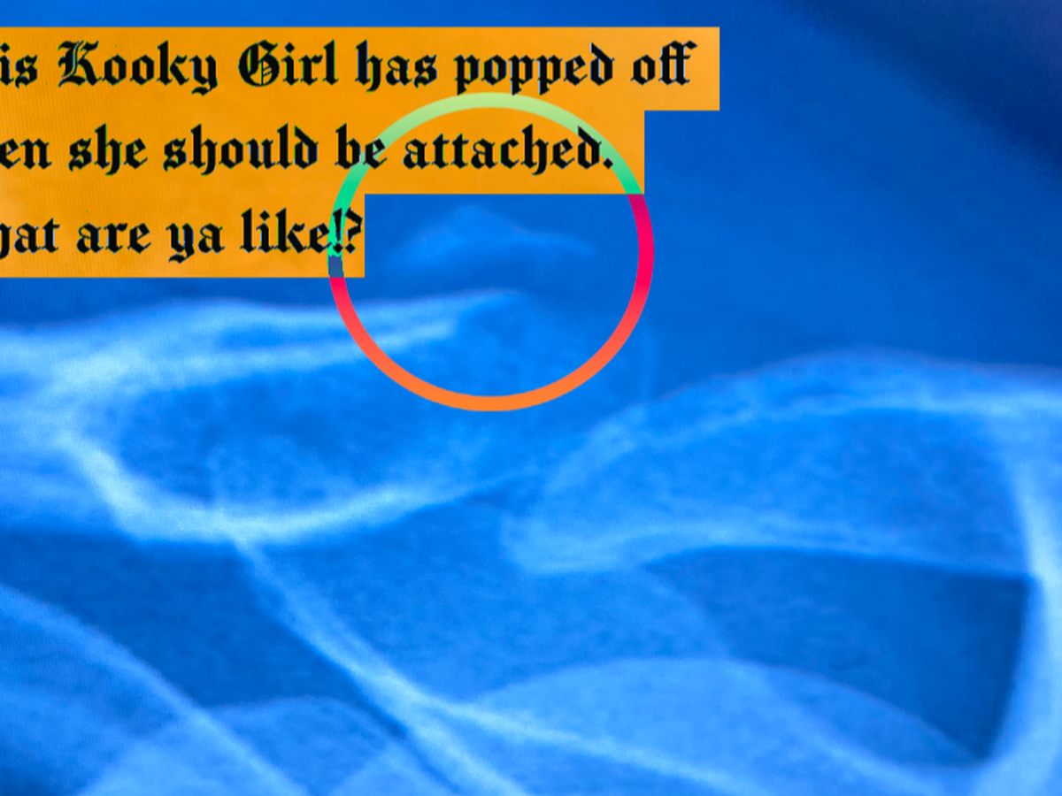 Fundraiser by oozing gloop : BBBBF- Broken bone, Burnout & Birthday ...