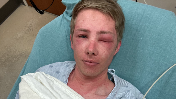 Fundraiser by Matt Cary : Support Matt's Recovery from Medical Crisis