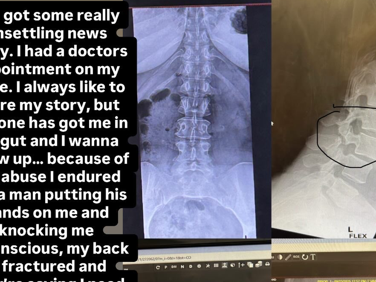 Fundraiser by Rebecca Atamian : Support Becki's Recovery and Stability