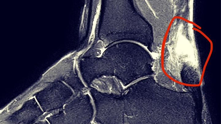 Fundraiser by Merilyn Julissa Rangel : Ricky needs surgery for his ...