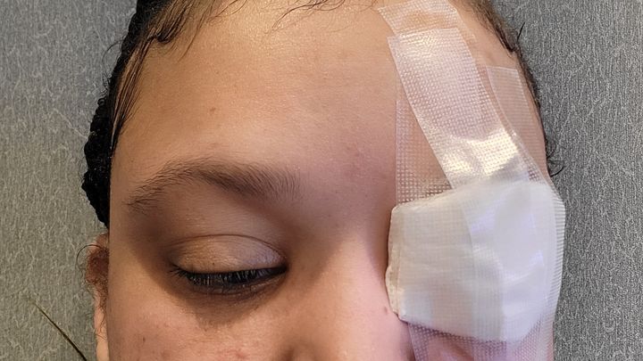 Fundraiser by Jennifer Moats : Saving My Eye Sight
