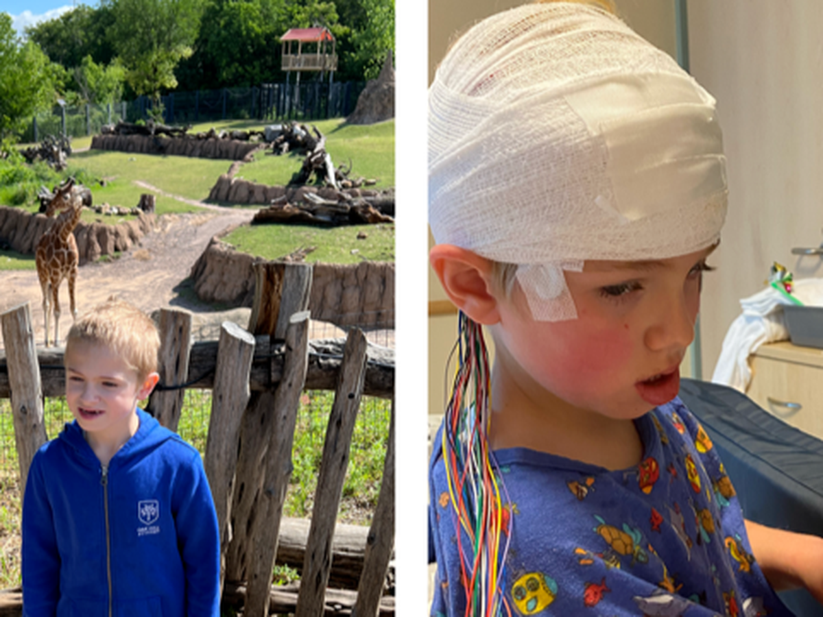 Fundraiser by James Acuff : Help Benjamin Overcome Focal Cortical Dysplasia