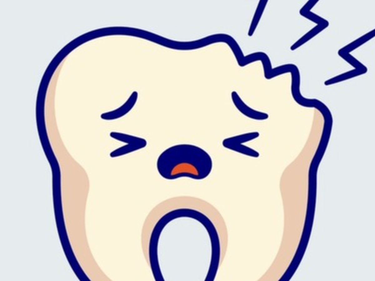 Fundraiser by Alex Estevenez : Emergency Dental Needed