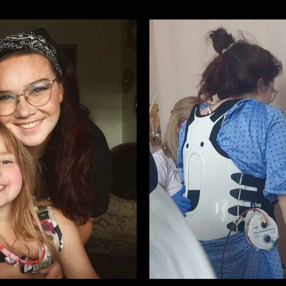 Girl With Broken Back