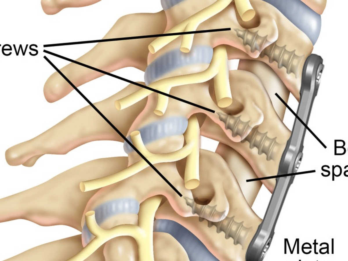Fundraiser for nicole ackley by kaitlyn sierra : Support Mom’s Recovery ...