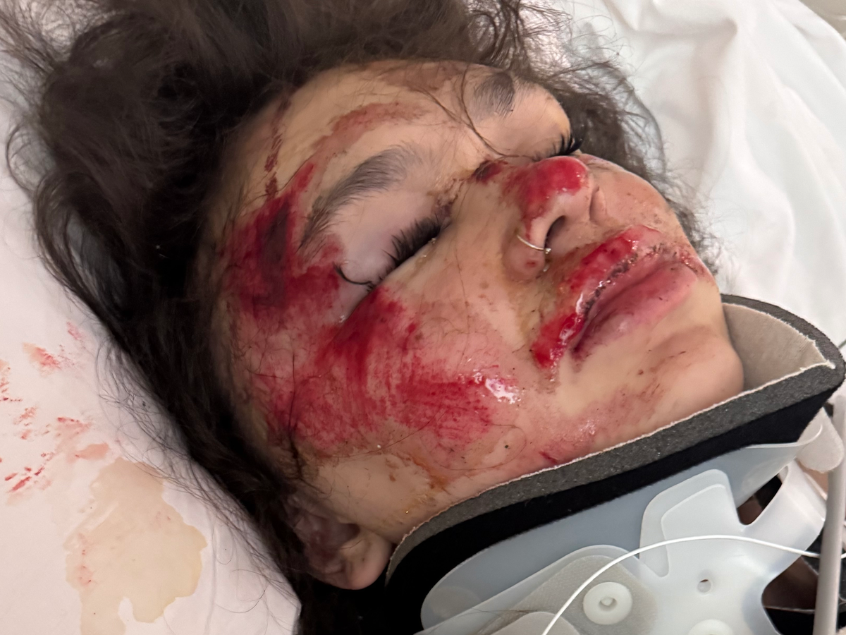 Fundraiser by Jessica Wallace : Support Hailee’s recovery in this time of crisis