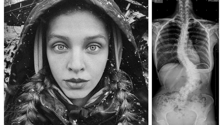 Fundraiser by Oksana Pierce : Help For A Ukrainian Girl Receive Vital ...