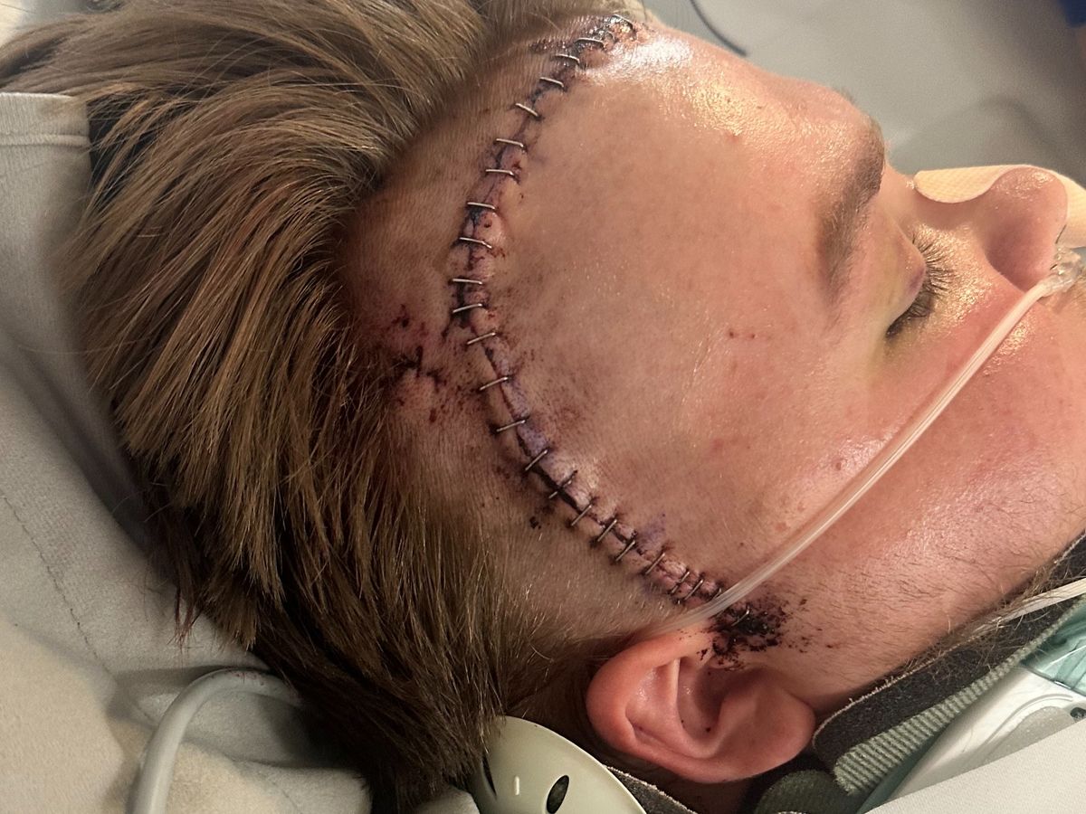 Fundraiser by Baylee Hooper : Support Hayden’s Recovery Journey