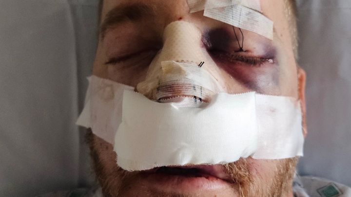 Fundraiser for Jesse Bebbino by Matthew Guzzardi : Jesse Bebbino