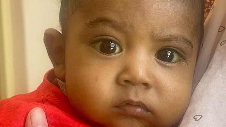 Fundraiser by Suman Daliya : Liver Transplant for a 6 month old baby.