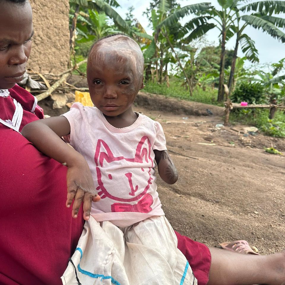 Fundraiser by Eric Kal : Support Winnie’s Critical Surgery