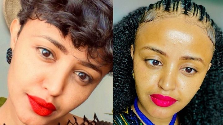 Fundraiser for Bruktawit Habtu by Mimi Tesfaye : "የአይኔን ብርሃን በአስቸኳይ ...