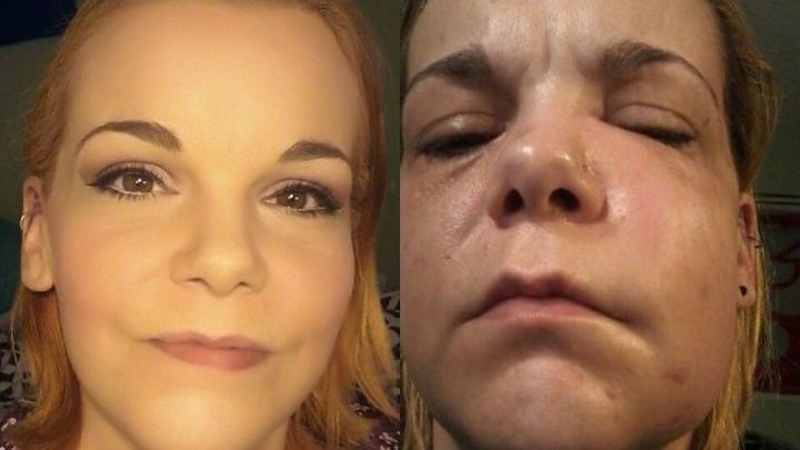 Fundraiser for Tara Abbott by Tristan Triller : Restore Tara's Smile