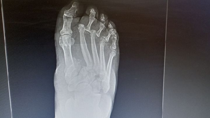 Fundraiser for Nancy Perryman by Jennifer Norman : Nancy has been ...